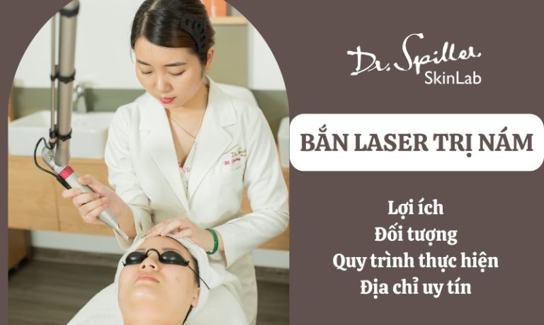 Bắn laser trị nám là gì? Có hiệu quả không? Chi phí điều trị
