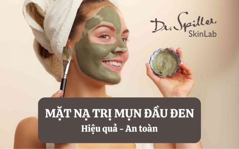 Top 5 cách làm mặt nạ trị mụn đầu đen tại nhà hiệu quả tốt nhất