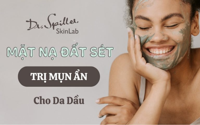 Top 4 loại mặt nạ đất sét trị mụn ẩn cho da dầu tốt nhất