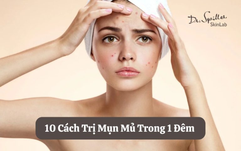 Top 10 cách trị mụn mủ trong 1 đêm hiệu quả bạn nên biết ngay
